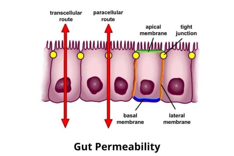 What Is Leaky Gut Syndrome? - FODMAP Everyday