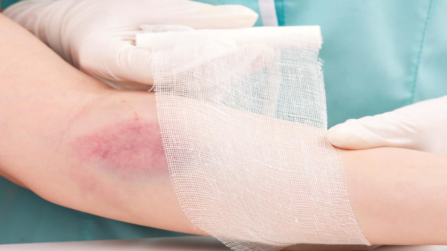11 uses for hydrogen peroxide you didn’t know about - FODMAP Everyday